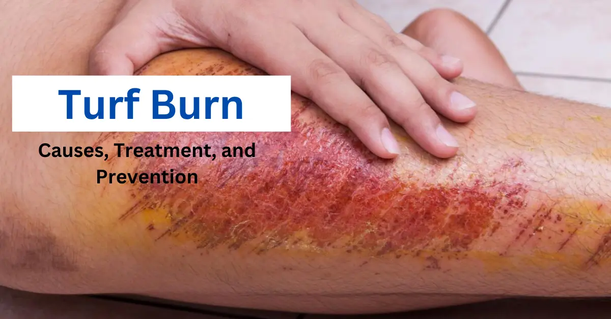 Understanding Turf Burn: Causes, Treatment, and Prevention